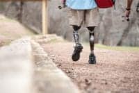 Prothèse fémorale - Réseau Ottobock Orthopédie & Services